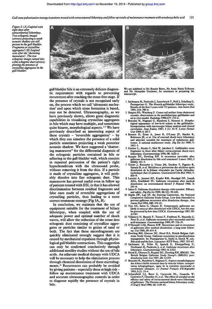 GALL STONE PULVERISATION STRATEGY - Litotrissia Extracorporea Roma